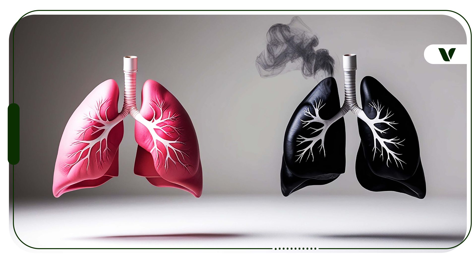 Is Marijuana Linked to Lung Cancer?Cannabis Central