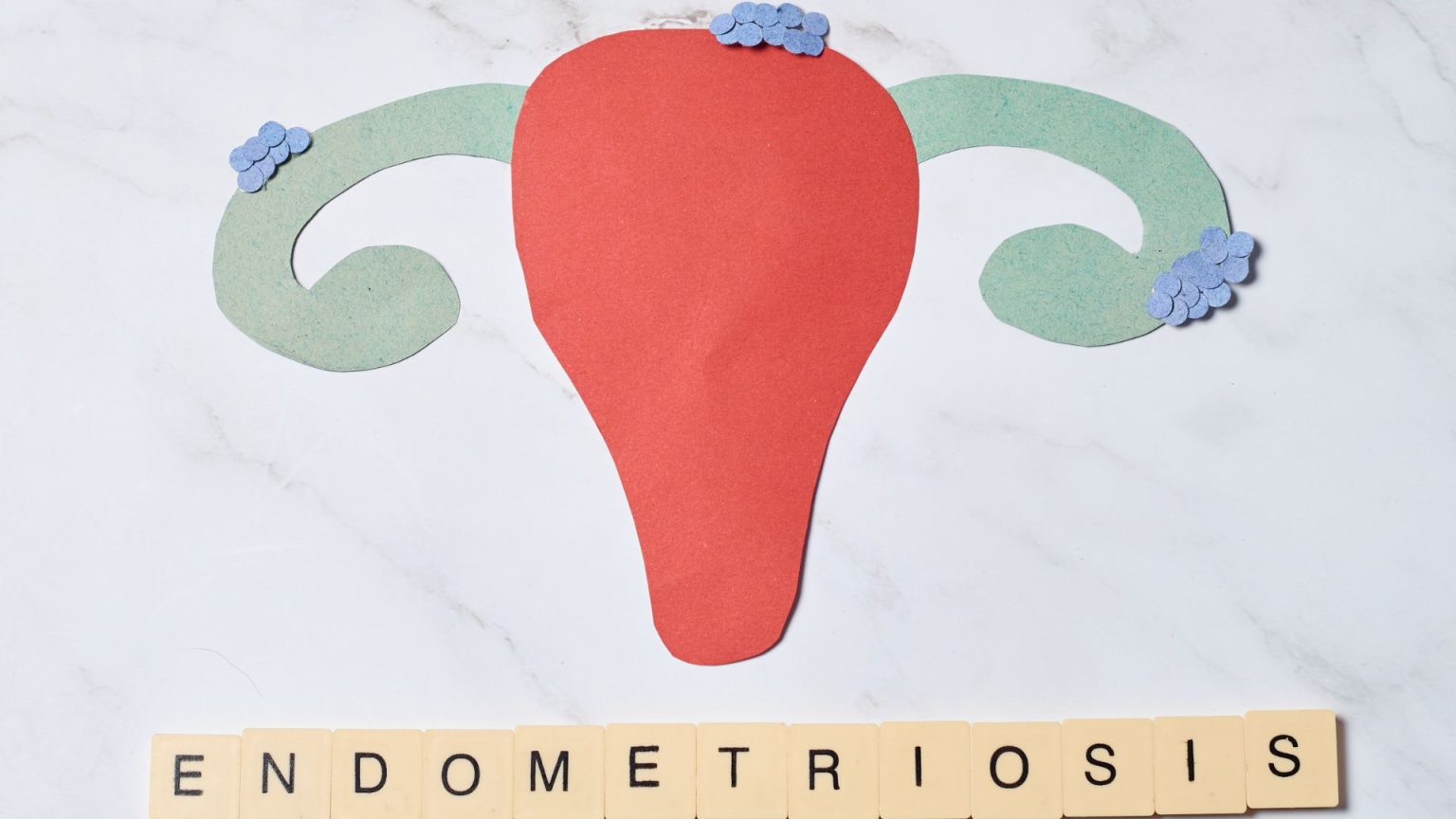 How Cannabis May Help Fibroids and Endometriosis ConditionCannabis Central