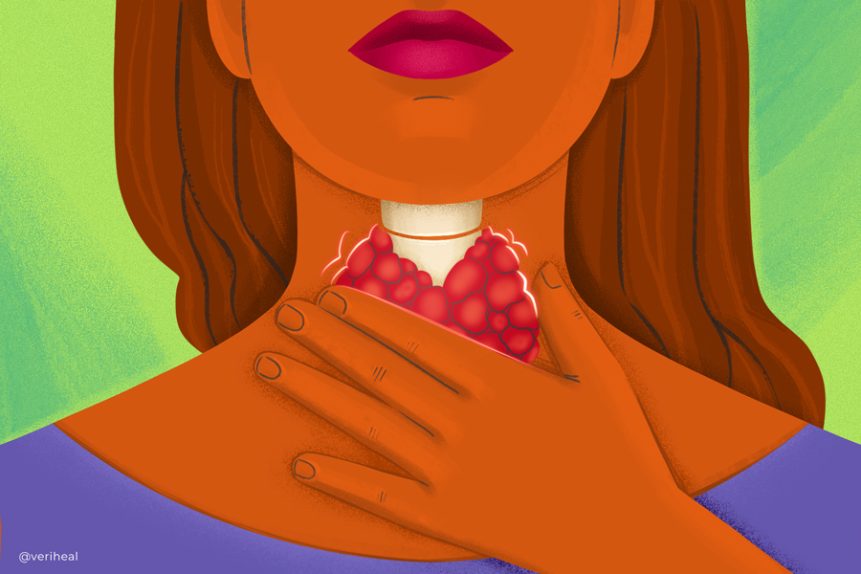 Thyroid Health: Can Medical Marijuana Help Plummer Disease?