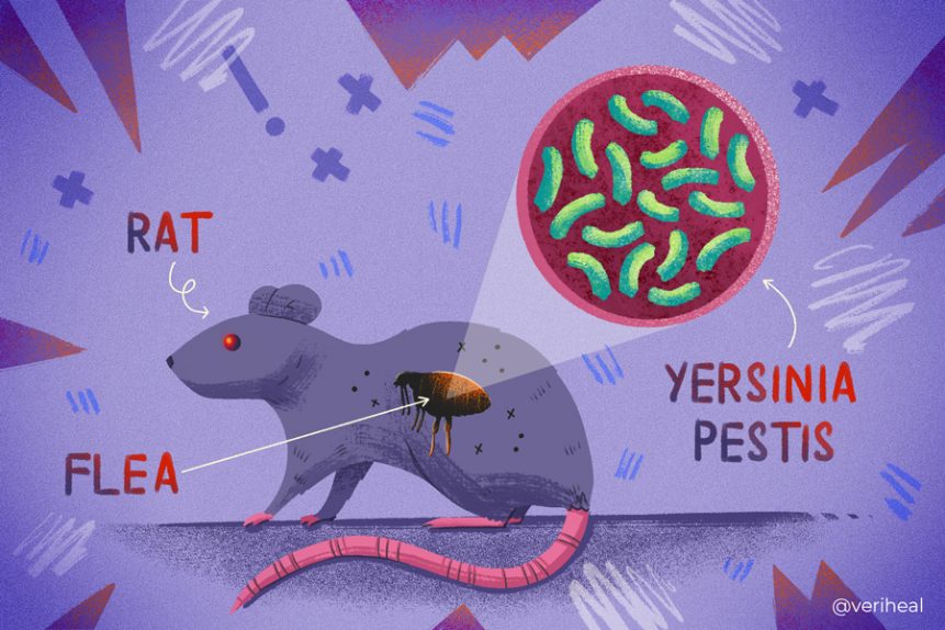 What Is The Characteristic Lesion Of Yersinia Pestis at Joseph Eason blog